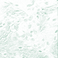 Colour Deconvolution – Novel context-based segmentation algorithms for intelligent microscopy