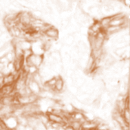 Colour Deconvolution – Novel context-based segmentation algorithms for intelligent microscopy