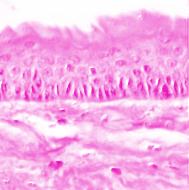 Colour Deconvolution – Novel context-based segmentation algorithms for intelligent microscopy