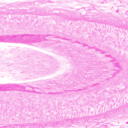 Colour Deconvolution – Novel context-based segmentation algorithms for intelligent microscopy