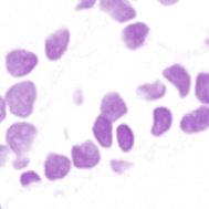 Colour Deconvolution – Novel context-based segmentation algorithms for intelligent microscopy