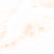 Colour Deconvolution – Novel context-based segmentation algorithms for intelligent microscopy