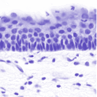 Colour Deconvolution – Novel context-based segmentation algorithms for intelligent microscopy