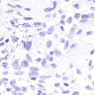 Colour Deconvolution – Novel context-based segmentation algorithms for intelligent microscopy