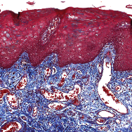Colour Deconvolution – Novel context-based segmentation algorithms for intelligent microscopy