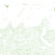 Colour Deconvolution – Novel context-based segmentation algorithms for intelligent microscopy