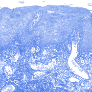 Colour Deconvolution – Novel context-based segmentation algorithms for intelligent microscopy