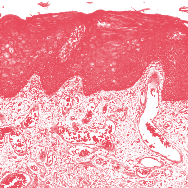 Colour Deconvolution – Novel context-based segmentation algorithms for intelligent microscopy